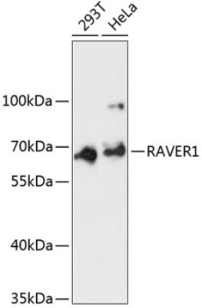RAVER1 Rabbit anti-Human, Mouse, Polyclonal, Novus Biologicals 100 μg; | Fisher Scientific